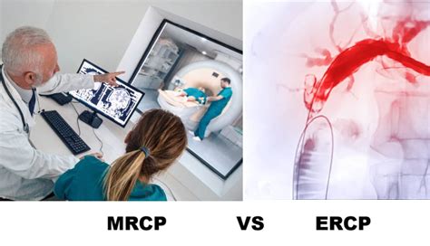 MRCP Vs ERCP The Hidden Risks You Need To Know Before Deciding Lifecarecure Com