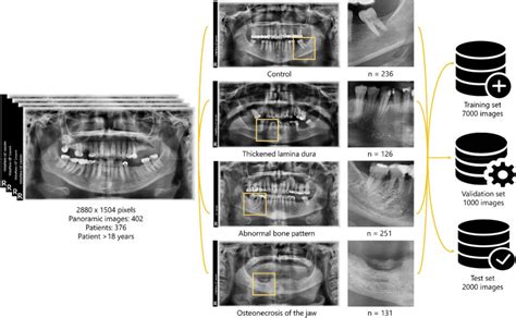Convolutional Neural Network For Automated Classification Of Osteonecrosis And Related