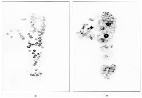 Figure 1 From 3 D Aggregated Object Detection And Labeling From