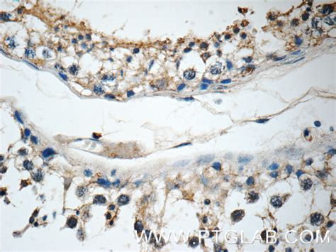 Iqck Antibody 25740 1 Ap Proteintech 武汉三鹰生物技术有限公司