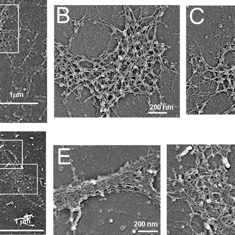 Schematic Diagram Of Collagen Vi Chains Microfibril Assembly And