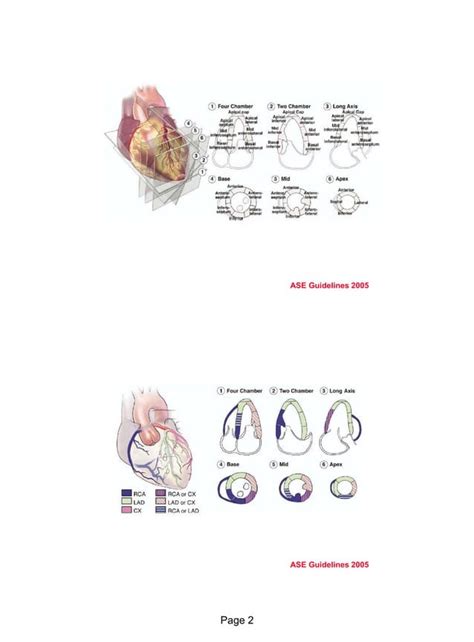 Echo In Ischaemic Heart Disease And Myocardial Infarction Pdf