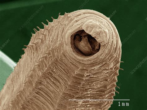 Coloured Sem Of Earthworm Stock Image F010 3029 Science Photo Library