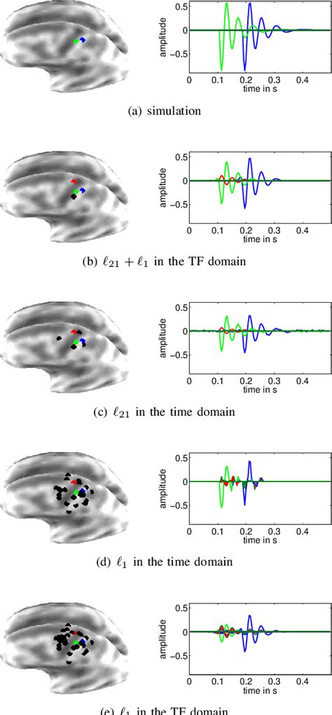 Figure 2 From Megeeg Source Reconstruction Based On Gabor Thresholding In The Source Space