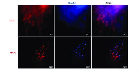 Neuronal Marker Expression In The Three Dimensional 3d Cultures