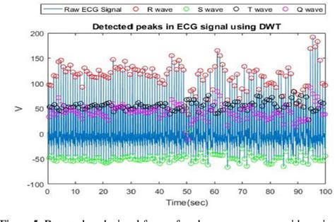 Figure 1 From Emotion Detection Through Electrocardiogram Signal