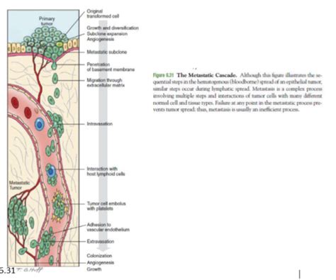 Pathology Neoplasia Flashcards Quizlet