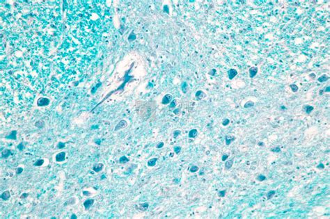 在实验室显微镜下观察小脑、丘脑、延髓、脊髓和运动神经元。