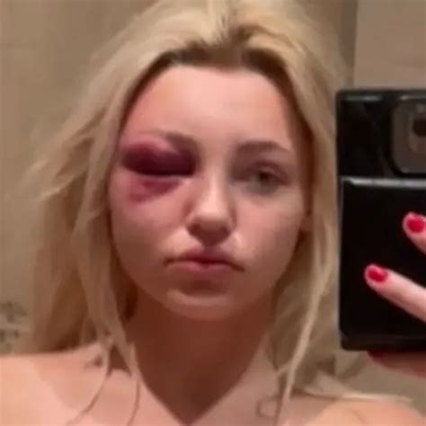 Psycho” Plastic Surgeon Allegedly Used Ex As Slave Forcibly Injected
