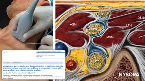 Nysora Nerve Blocks App Nysora