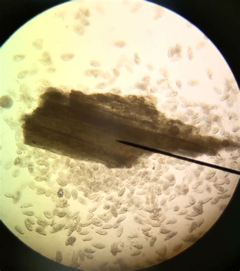 Protista Cells Under Microscope Protists Microscope Slides