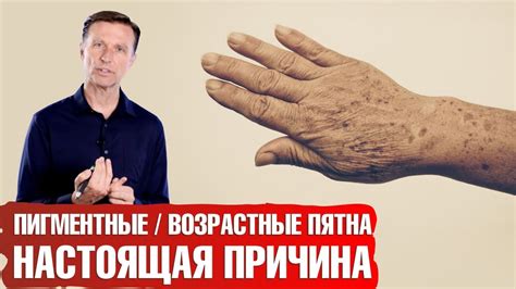 Печень и пигментные пятна на лице как убрать пигментацию при