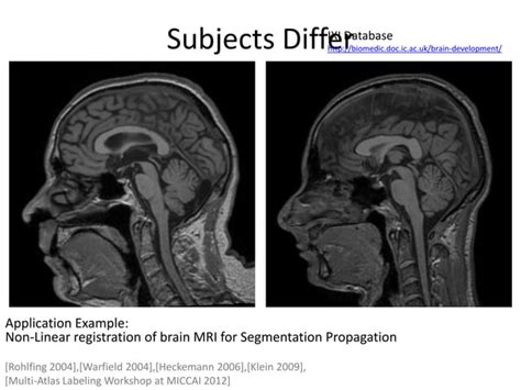 Introduction To Deformable Registrationpdf