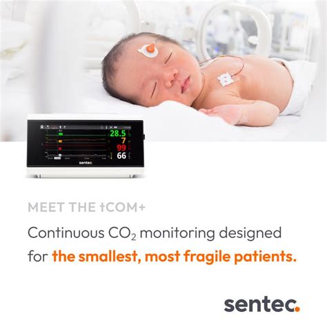 Nicu Patients Have Unique Needs And The Technology Supporting Them