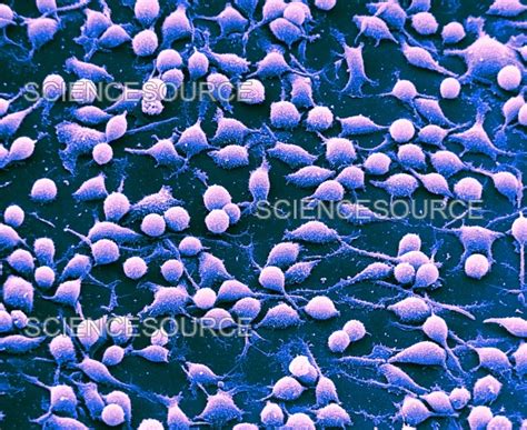 Fibroblasts In Culture Sem Stock Image Science Source Images