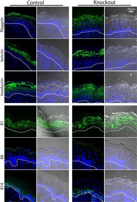 Normal Distribution Of The Differentiation Markers In Download Scientific Diagram