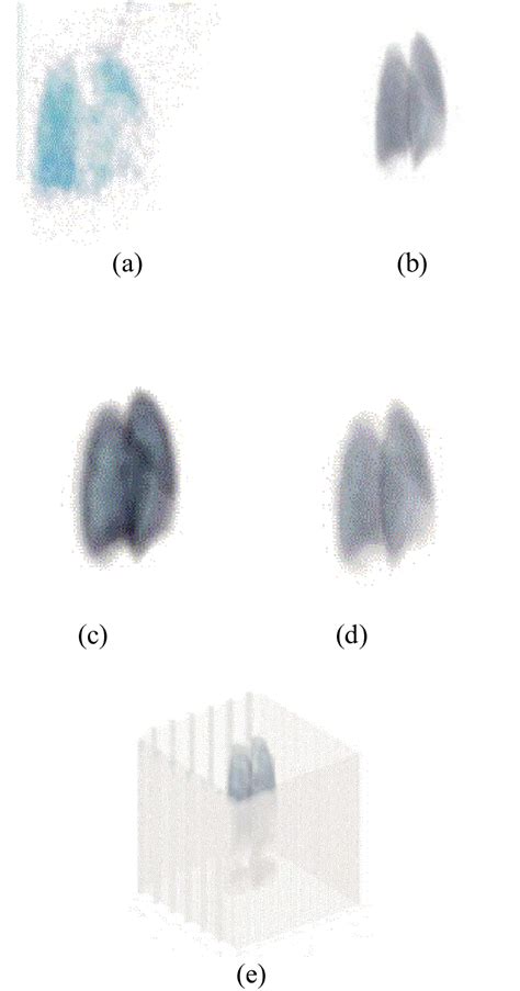 Attenuation Correction Of Lung Spect Images A No Corrected Image B Download Scientific