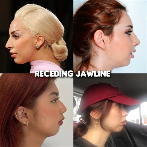 Selflove Xoxo On Instagram Which One Do You Choose Defindjawline Softjawline