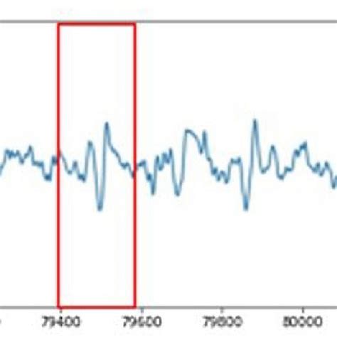 An Eeg Signal With The K Complex Marked With A Bounding Box Download