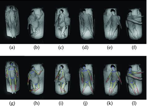 In Bed Pose Estimation Deep Learning With Shallow Dataset Pmc