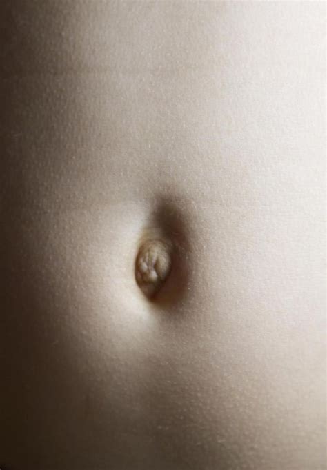 Woman Wins Settlement For Exploding Belly Button After Surgery Belly Button Women Belly