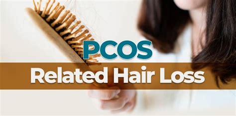 polycystic ovary and hair loss specialit treatment clinic lahore pakistan