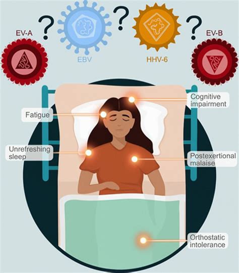 Fatigue Syndrome Day Me Awareness Week The Me Association