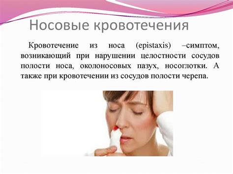 Носовые кровотечения при системных заболеваниях соединительной ткани ...