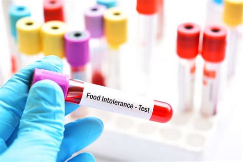 Nutrition Evidence Alert April 2022 Igg Food Sensitivity A