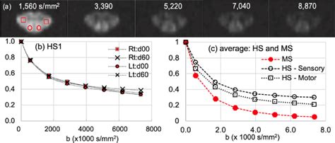 A Series Of Dw Images With B 1560 ~ 8870 Smm 2 And Diffusion