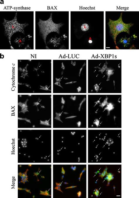 Xbp1s Overproduction Increases Bax Translocation And Cytochrome C Download Scientific Diagram