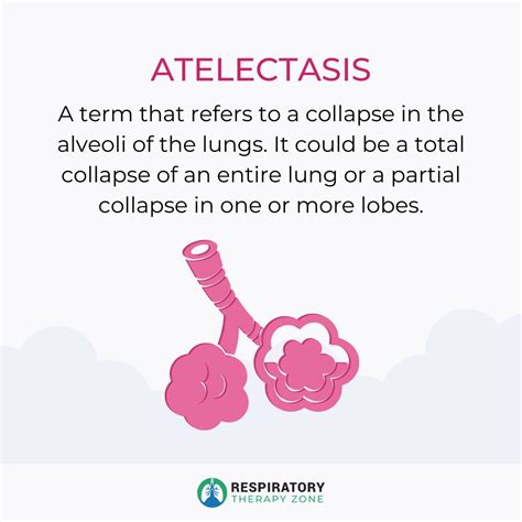Atelectasis A Term For Lung Collapse Respiratory Therapy Zone Posted On The Topic Linkedin