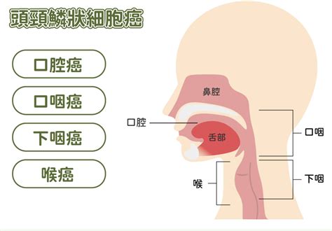 口咽癌放射治疗技术昆明口咽癌医院那家好一点 昆明医科肿瘤医院