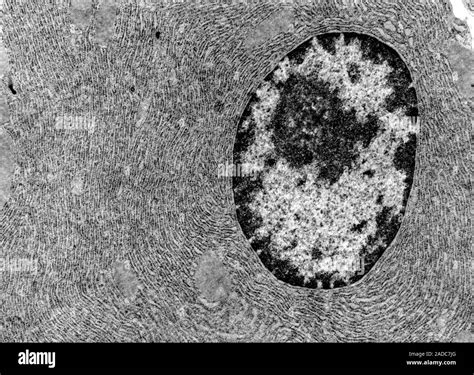 Transmission Electron Micrograph Tem Showing The Nucleus With A Large Nucleolus And The