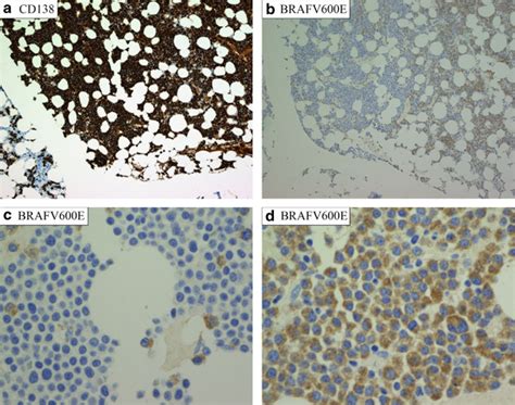 Ihc Showing Fraction And Growth Pattern Of Braf V600e Mutated Plasma Download Scientific