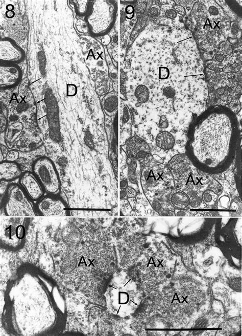 Electron Micrograph Showing A Dendrite D In Longitudinal Sections