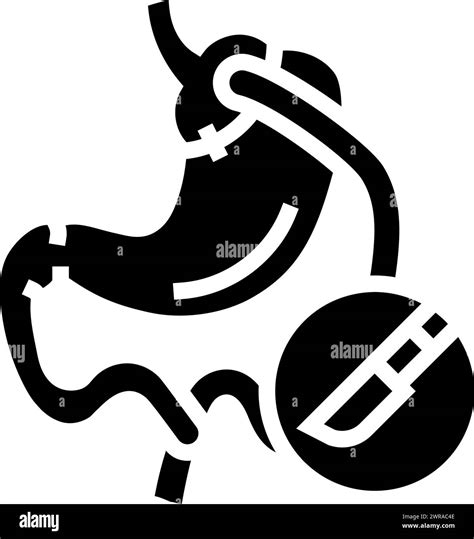 Gastric Bypass Surgery Glyph Icon Vector Illustration Stock Vector Image And Art Alamy