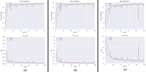 Dice Coefficient And Dice Loss Training Curves Of The Rv Segmentation