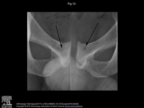 Dean K Matsuda M D Nicole A Matsuda Rachel Head B S Ppt Download