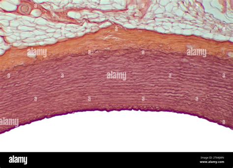 Elastic Artery Histological Section Of An Elastic Artery Human Aorta Orcein Staining Stock