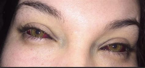What Color R Whatismyeyecolour