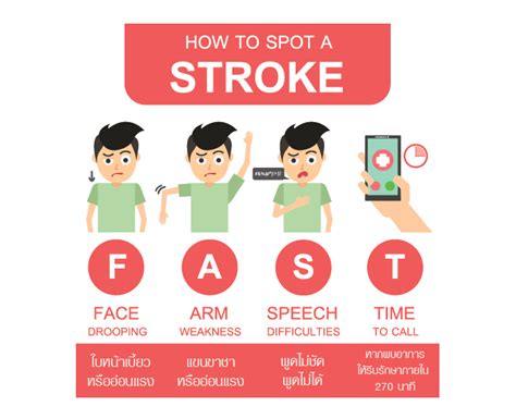 เตียงไฟฟ้า กับการดูแลผู้ป่วย Stroke อีไลฟ์ สินค้า ผู้สูงอายุ Ergonomics เพื่อชีวิตที่ดีขึ้น