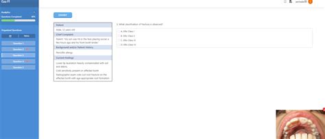 Inbde Booster Review And Discount Code 2023 Is It The Best Inbde Prep Course