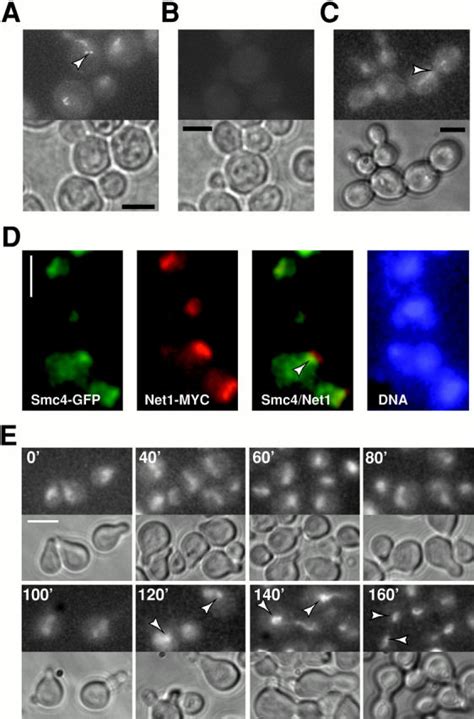 Condensin Localization A Condensin Localization Visualized By