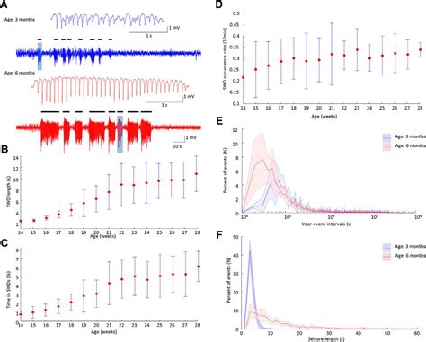 Spike And Wave Discharges Are Not Pathological Sleep Spindles Network