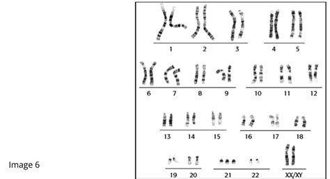 Solved Notice How The Sex Chromosomes Are Depicted In Image