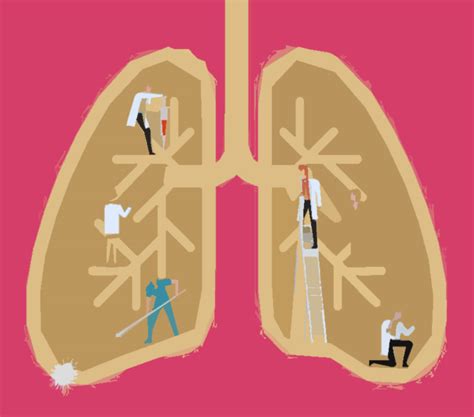 Does Suboxone Make You Tired Discover The Truth Behind Suboxones Potential Side Effects