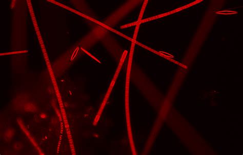 Scale Bar Tools For Microscopes Gilles Carpentier Research Web Site Computer Image Analysis