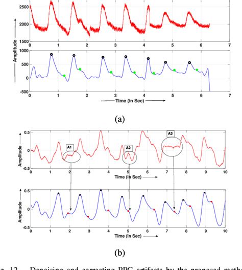 Figure 12 From Exploiting Tunable Q Factor Wavelet Transform Domain Sparsity To Denoise Wrist Figure 12 From Exploiting Tunable Q Factor Wavelet Transform Domain Sparsity To Denoise Wrist