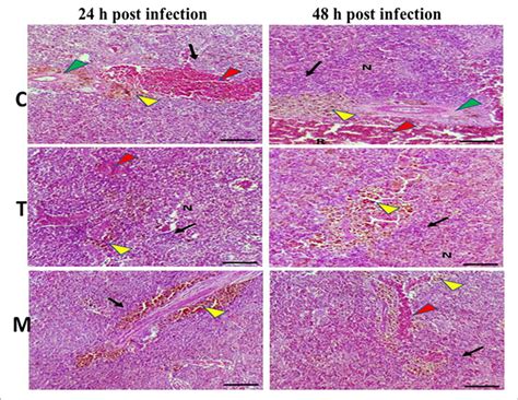 Hande Stained Histomicrograph Of Spleen Of Tilapia Following 24 And 48 Download Scientific